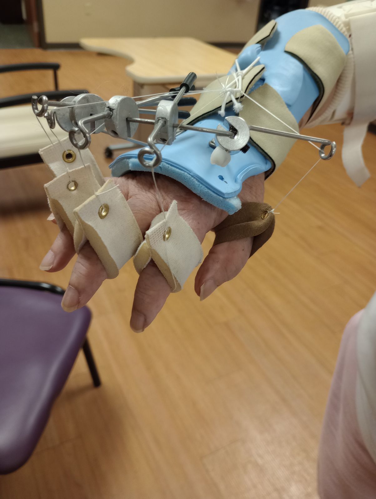 Expert Custom Splinting & Hand Therapy at CORE | Daviess Community Hospital