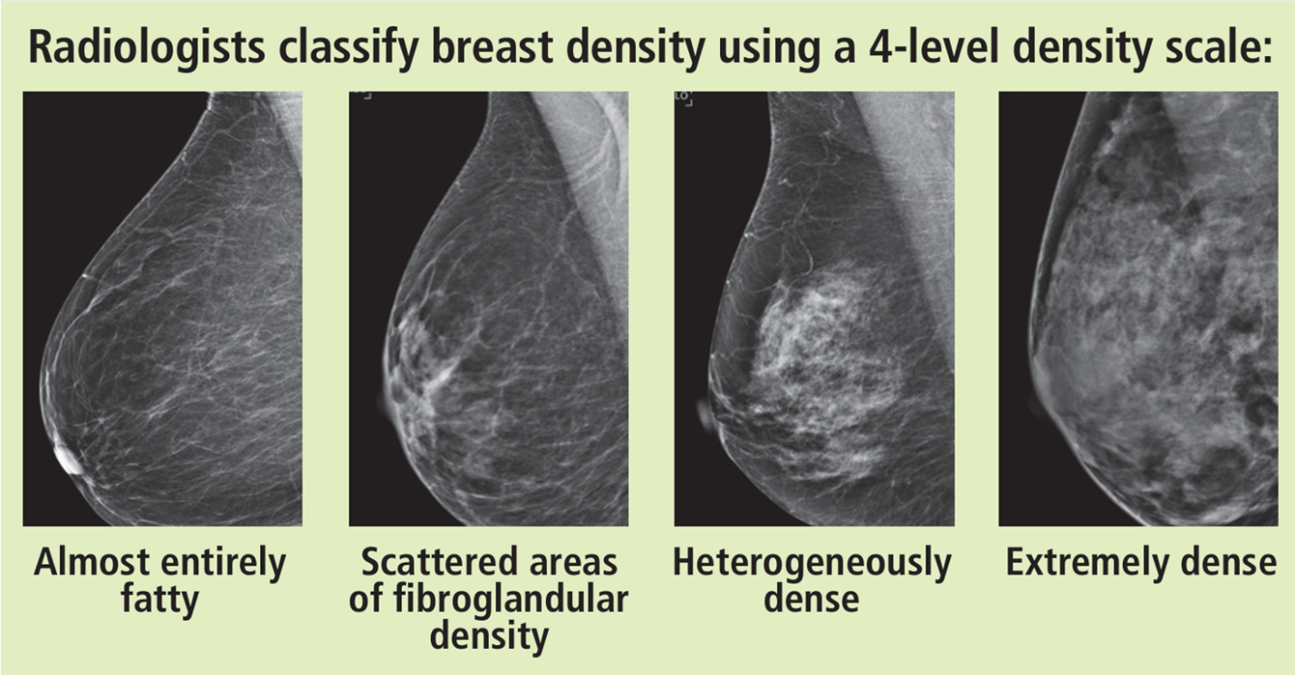 Dense Breasts & 3D Mammograms in Southwestern Indiana | DCH